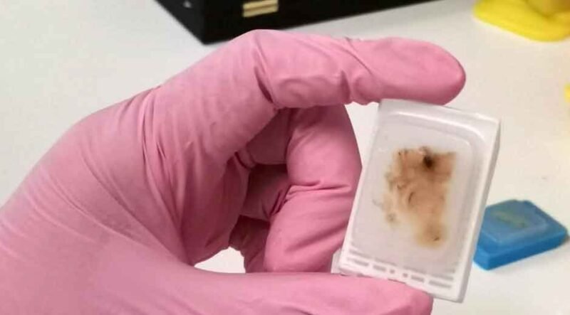 Exploring the Vital Role of FFPE Tissue Blocks in Diagnostics - The ...